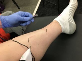 Radial Pressure Wave Therapy | Together Let’s Start the Journey of ...